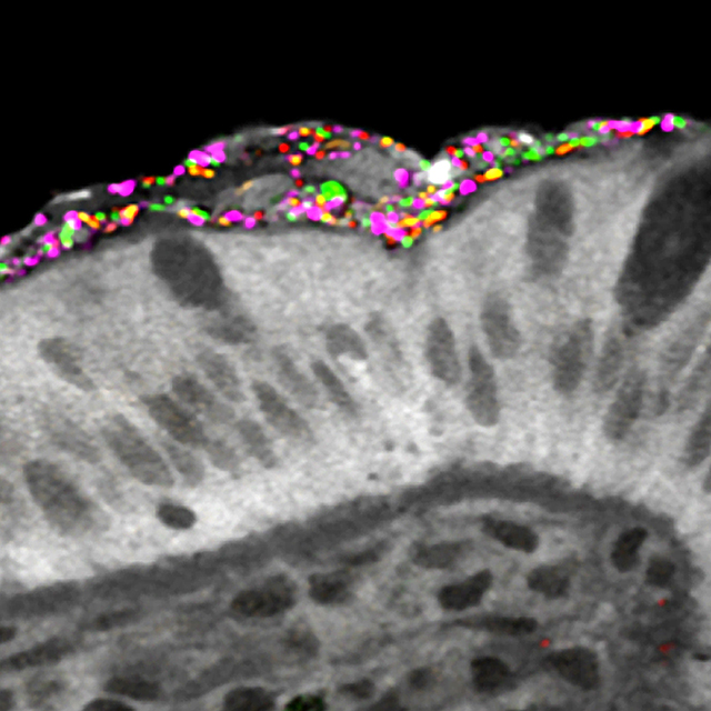 New Clues to Colon Cancer Lie in Biofilm | Johns Hopkins Medicine