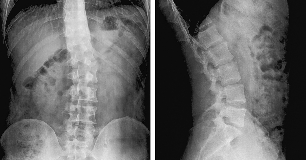 A New Approach to Preserving Spine Mobility in Middle-aged Adults ...