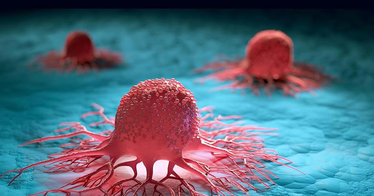 A Conversation About Cancer | Johns Hopkins Medicine