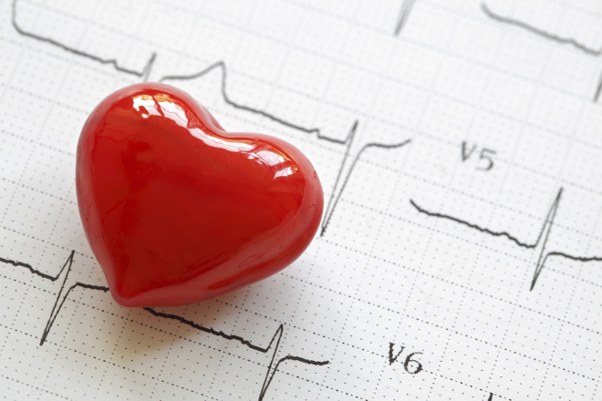 5 Things You Should Know about Atrial Fibrillation (AFib) | Johns ...