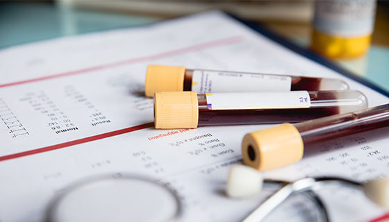 Prediabetes | Johns Hopkins Medicine