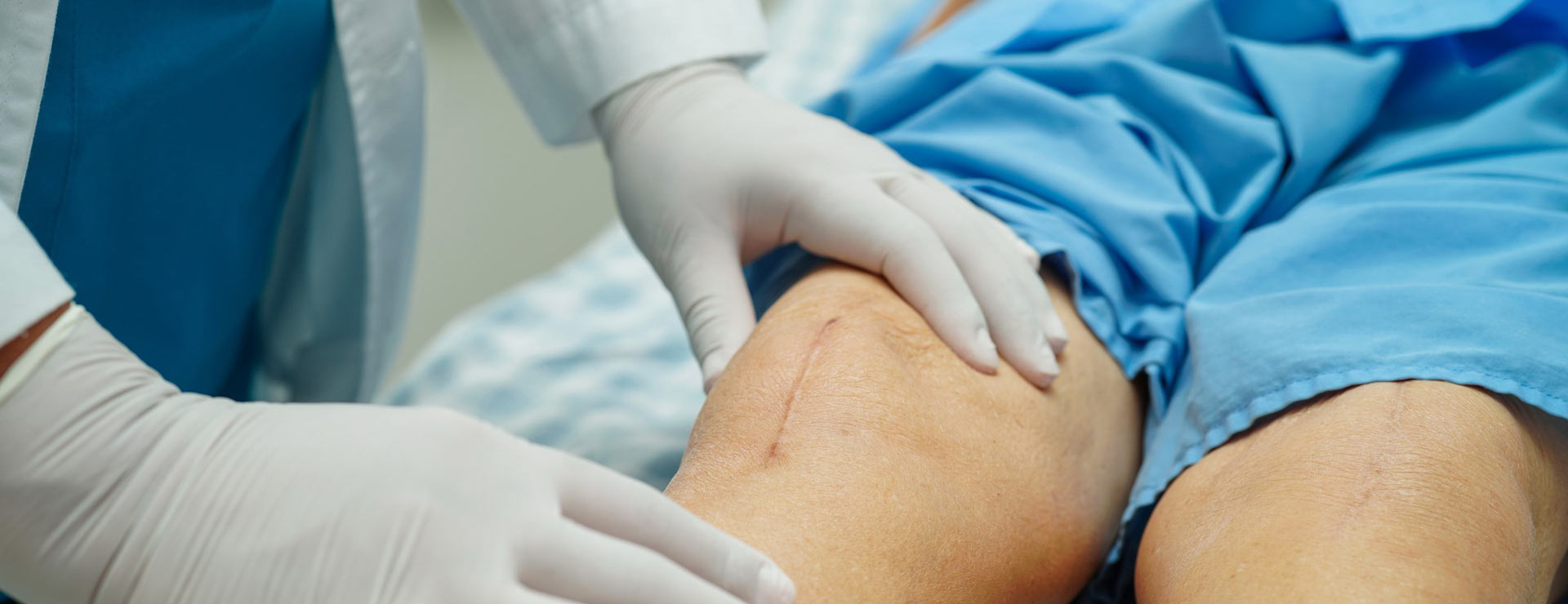 Scars | Johns Hopkins Medicine