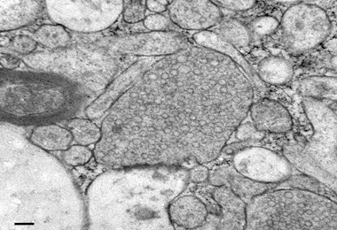 ‘Zap-and-Freeze’ Technique Successfully Used to Watch Human Brain Cell ...