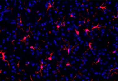 News Releases | Johns Hopkins Medicine